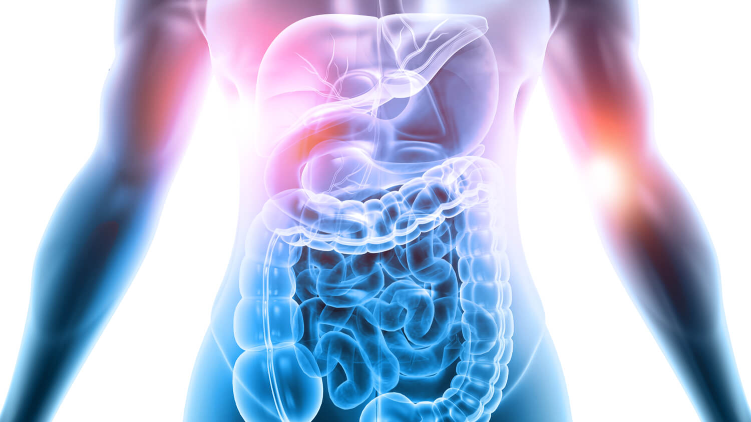 Darmkrebs Therapie - Dr. Klaus Emmanuel